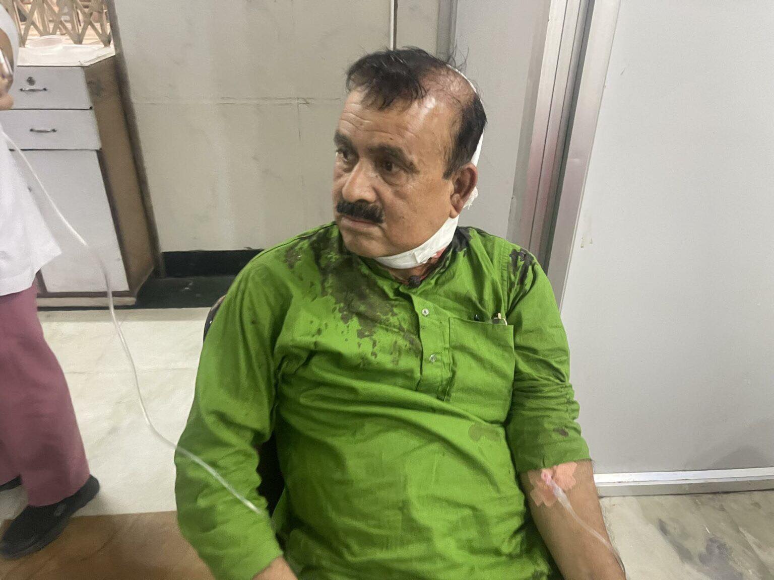 कांग्रेस सहमहामन्त्री यादवलाई आइसियुमा राखेर थालियो उपचार :: सेतोपाटी ...